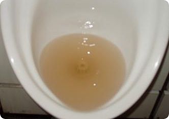 Blocked-Urinal-leeds | T.P.S Plumbing and Drainage